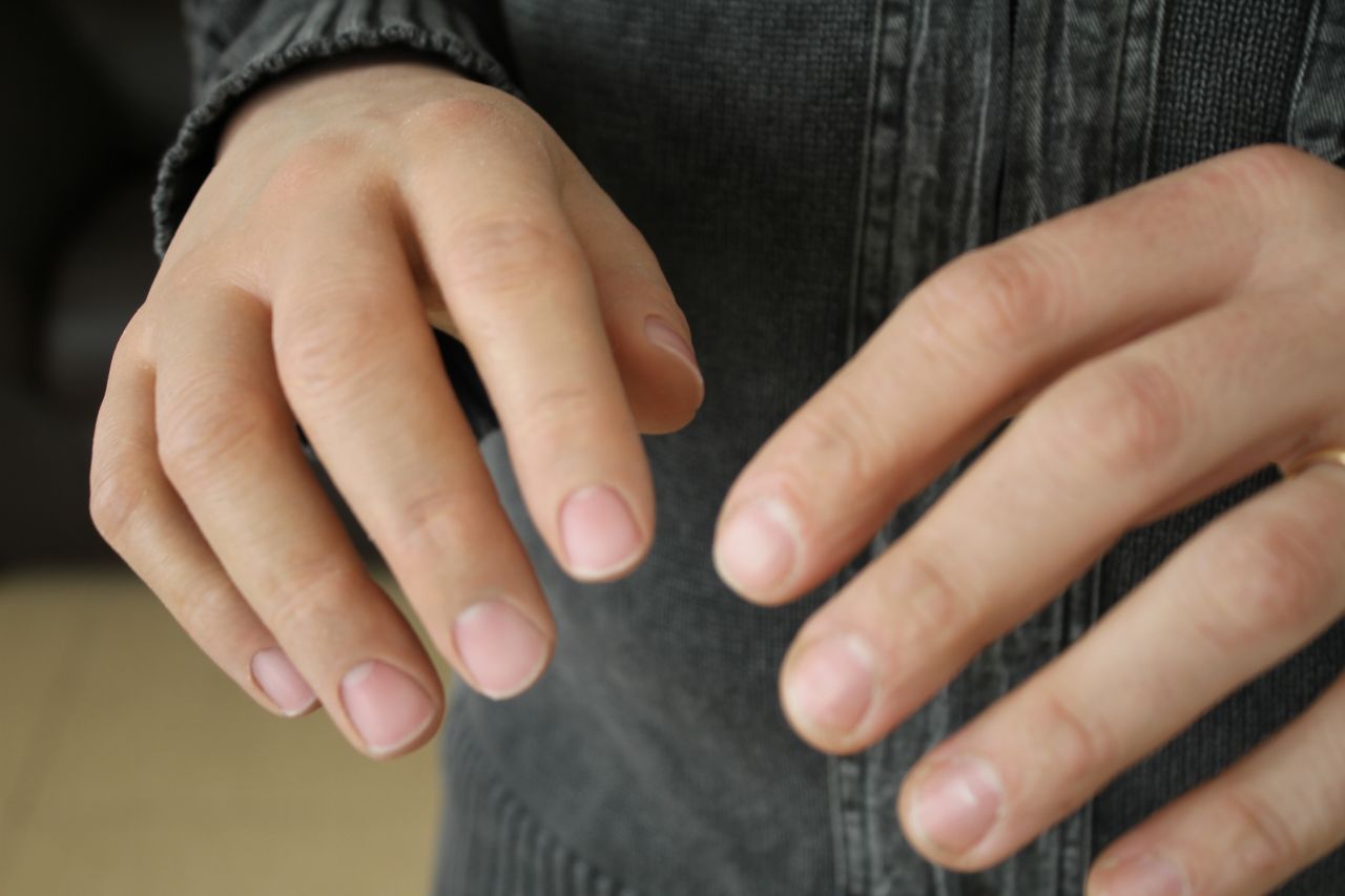 Protesi passive o estetiche in silicone - Mac Dowell Silicones