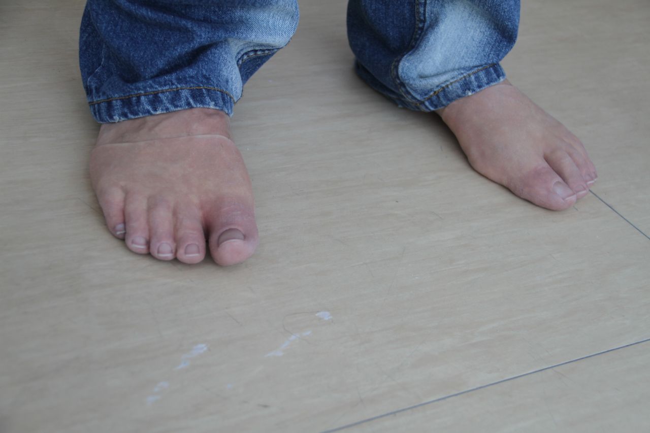 Protesi passive o estetiche in silicone - Mac Dowell Silicones