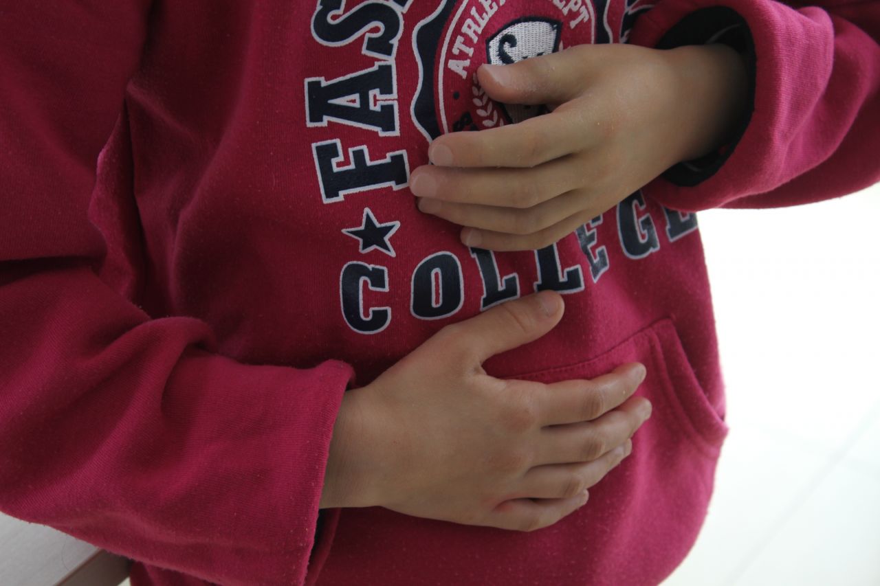 Protesi passive o estetiche in silicone - Mac Dowell Silicones